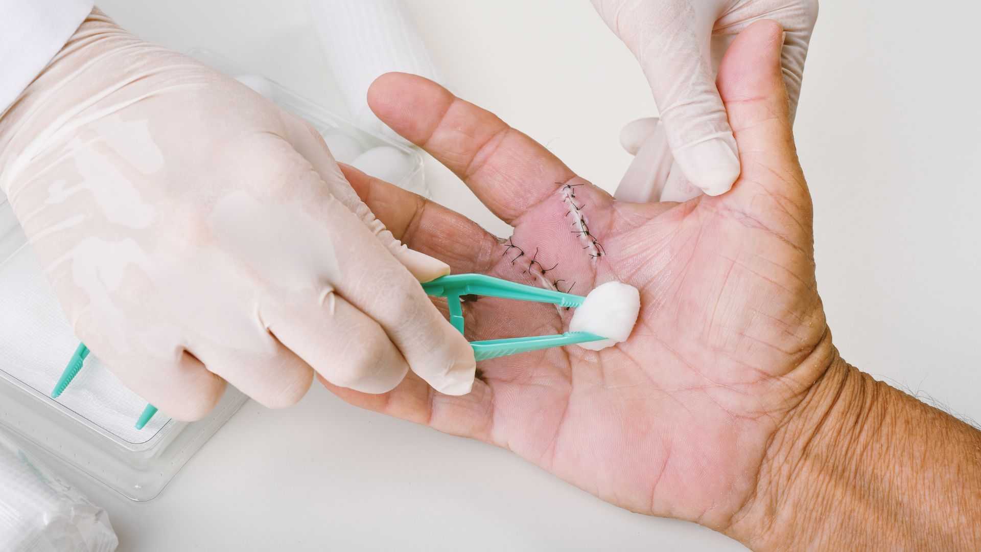 Daftar Spesialis Dokter Bedah Tangan Terkini Di Penang